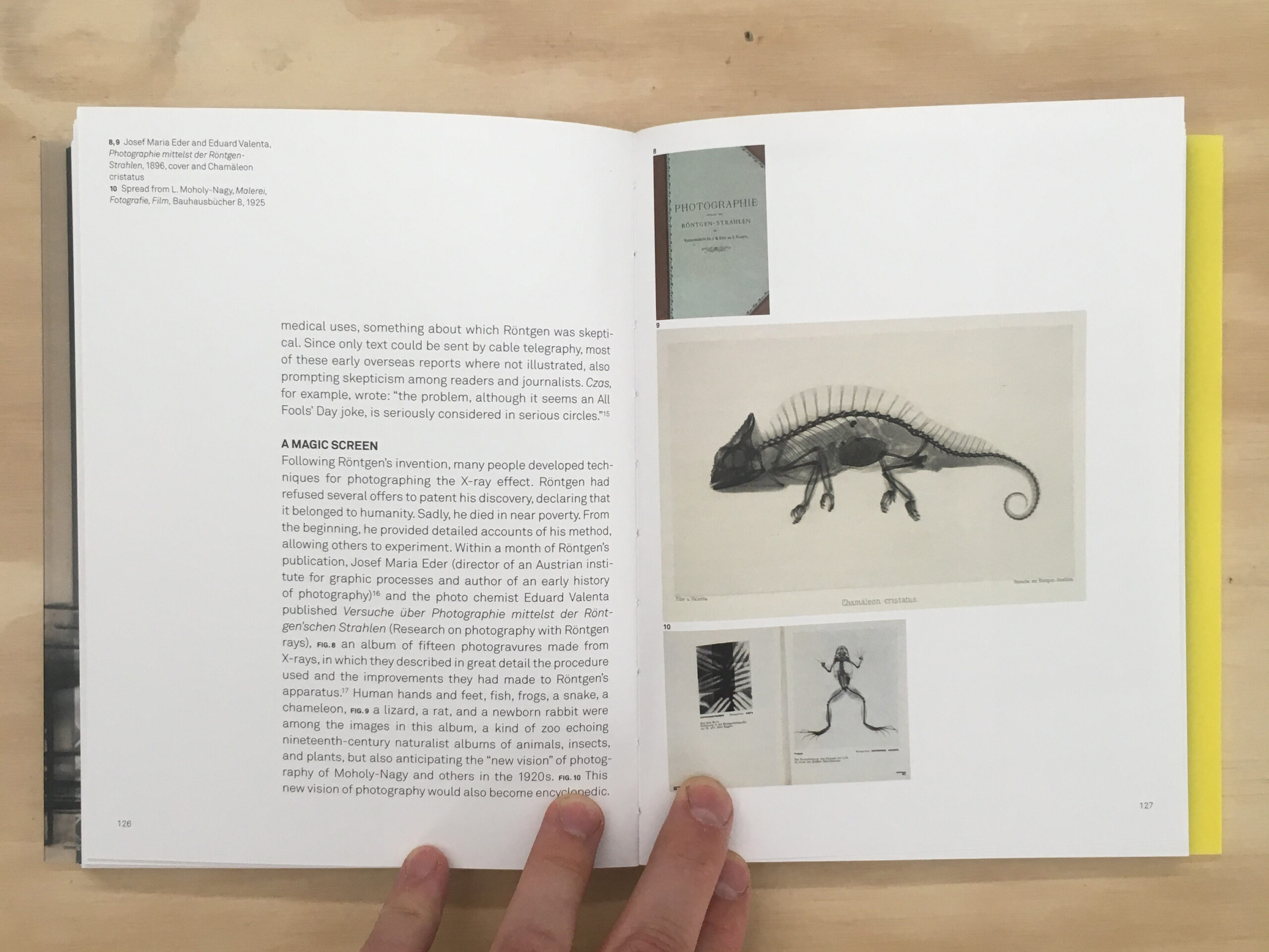 X-Ray Architecture: Modernism and Tuberculosis - Archis